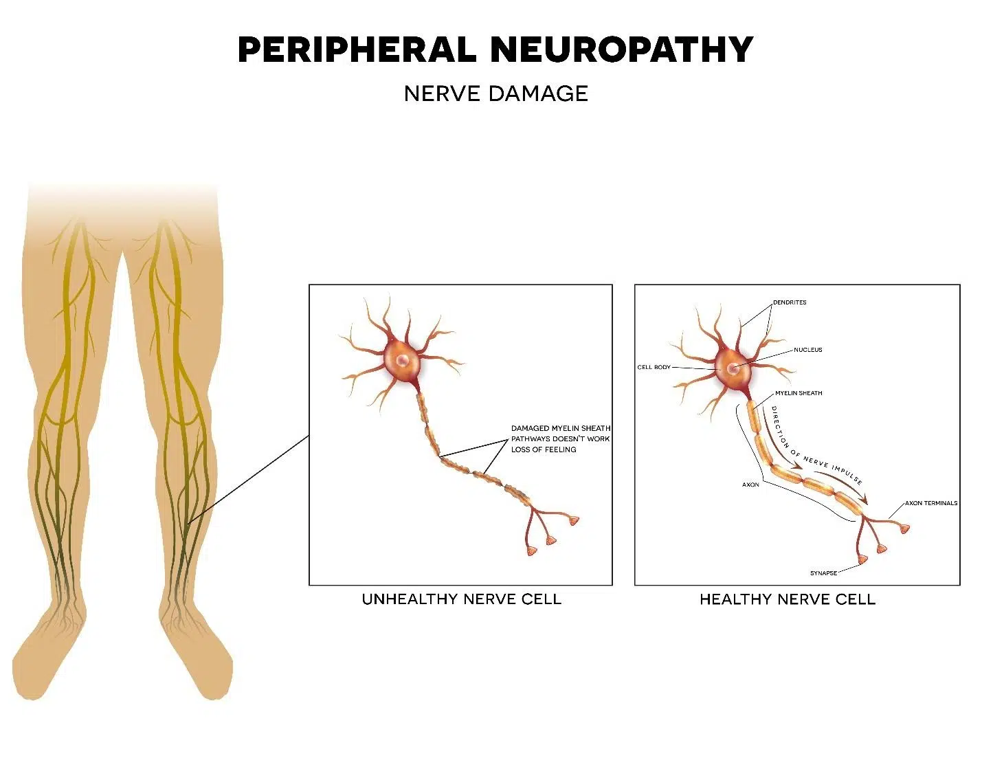 Nerve Blocks for Pain Relief | Targeted Non-Surgical Pain Management